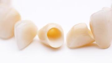 Getting a New Dental Crown? | Cook Family and Cosmetic Dentistry
